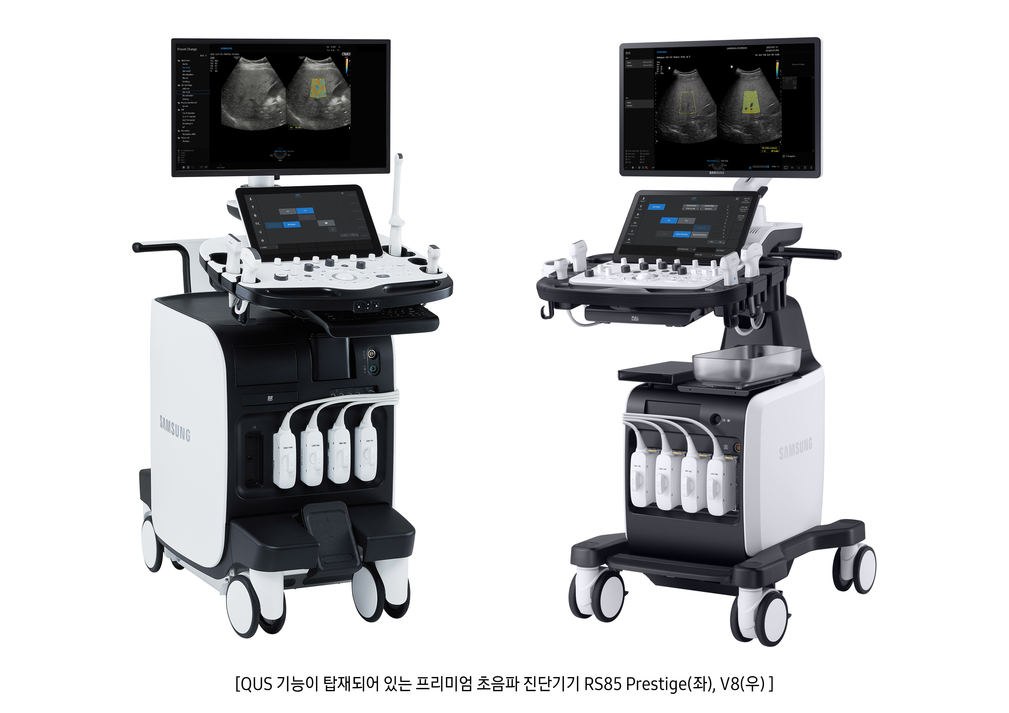 삼성메디슨, 'RS85 Prestige' 연구성과 발표
