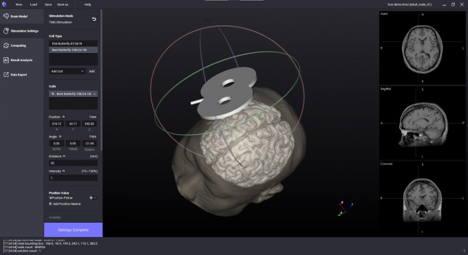 ‘NEUROPHET TMS LAB’ 뇌영상 치료계획 SW인증